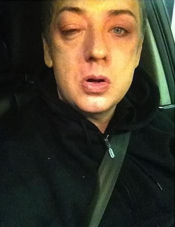 Boy George Assaulted