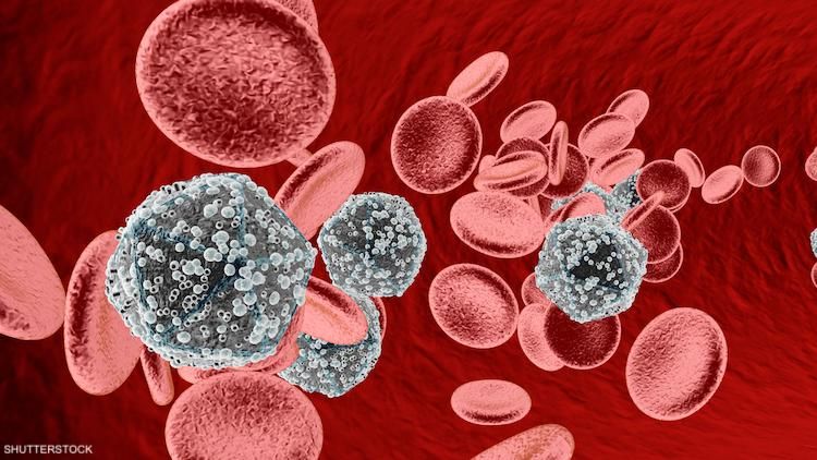 Scientists Have Discovered the First New Strain of HIV in 19 Years